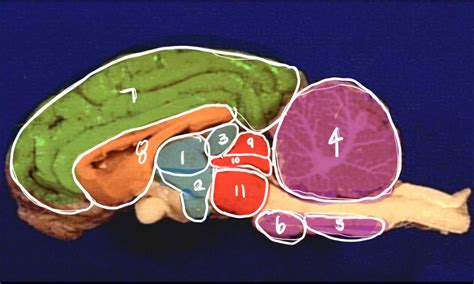 Brain Bisection Diagram Quizlet