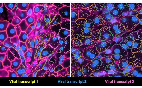 Xenium Advantage 10x Genomics