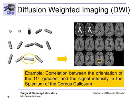Ppt Diffusion Tensor Imaging From Dicom To Nrrd Powerpoint Presentation Id 4462032