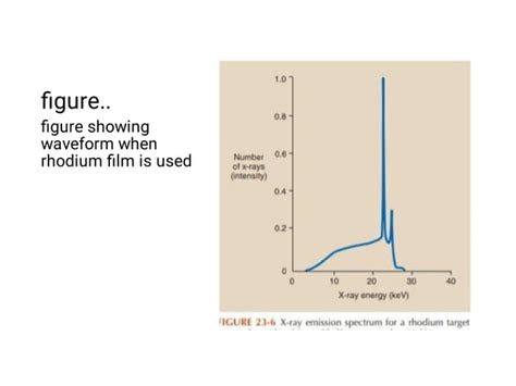 Mammography Radiologypdf