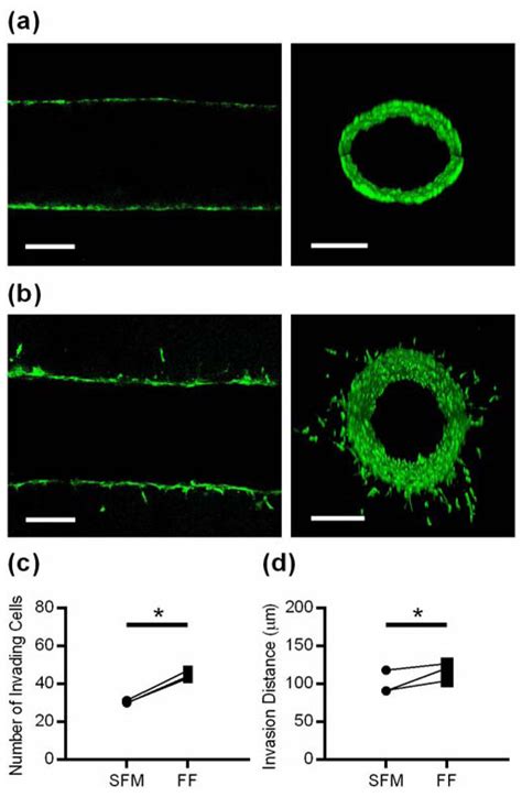 A Confocal Slice And Z Stack Cross Section Reconstruction Of