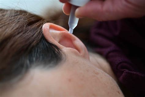 How To Use Hydrogen Peroxide For Earwax Removal Plus A Step By Step Guide