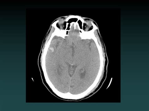 Introductory Neuroimaging What You Need To Know At 3 Am And Some Cool Stuff презентация онлайн
