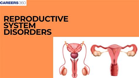 Disorders Of Human Reproductive System Types Causes Symptoms