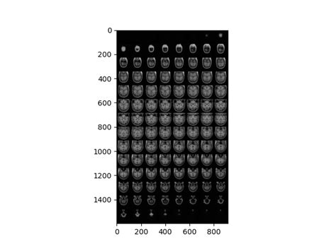 Model Starts To Overfit Right Away Vision PyTorch Forums