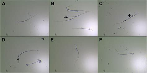 The Optical Micrographs Of Morphology Of Normal And Malformed Sperms A