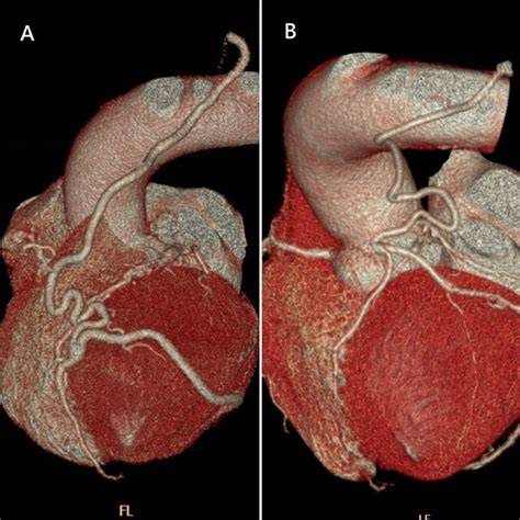 Three Dimensional Reconstructed Multidetector Computed Tomography Download Scientific Diagram