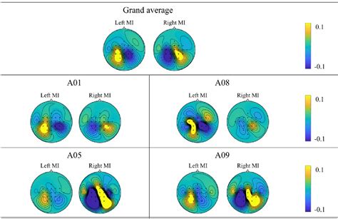 Figure 1 From Interpretable Convolutional Neural Networks For Subject Independent Motor Imagery