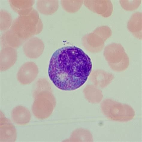 Myelocytes Identification And Differentiation