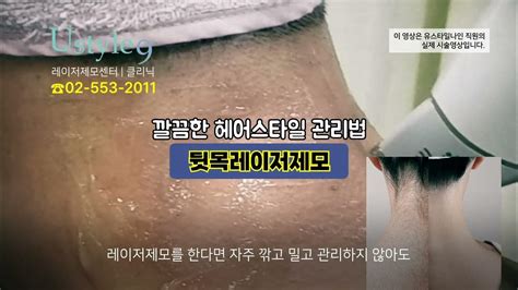 강남뒷목제모 뒷모습도 깔끔해야 합니다 Youtube