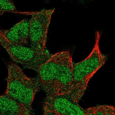 Rabbit Polyclonal Anti Dmap1 Antibody Buy For Research Highly