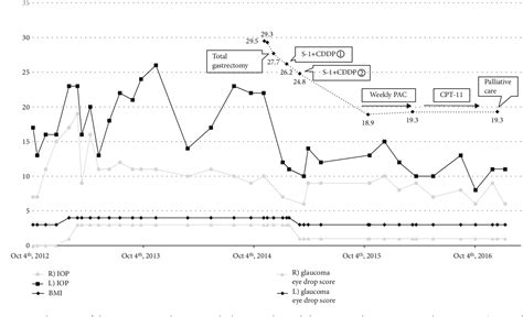 Figure 1 From A Glaucoma Patient With An Intraocular Pressure Decrease Following Total