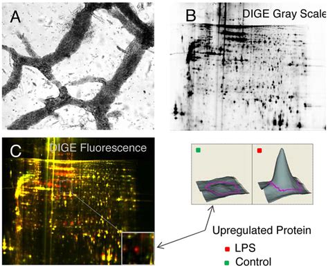 A Proteomic Analysis Of Human Stomach Myenteric Plexus After Endotoxin