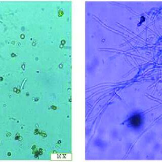 Characteristics Of False Smut Spores And Mycelium Under Microscope
