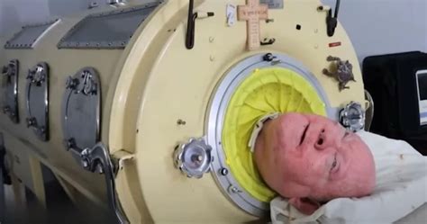 Man Spends 70 Years In An Iron Lung Inspires The World With His Life