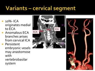 Normal Cerebral Angiogram Final Pptx