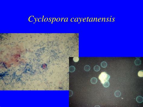 Ppt Dental Optometry Parasitology Powerpoint Presentation Free