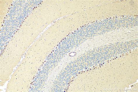 Nmdar1grin1 Antibody 27232 1 Ap Proteintech