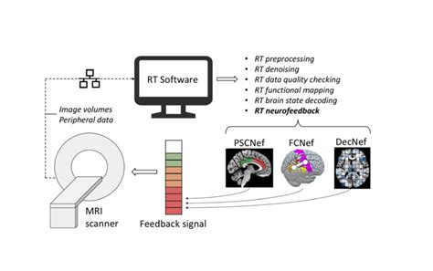 Real Time Fmri Neurofeedback To Better Identify And Treat Cognitive