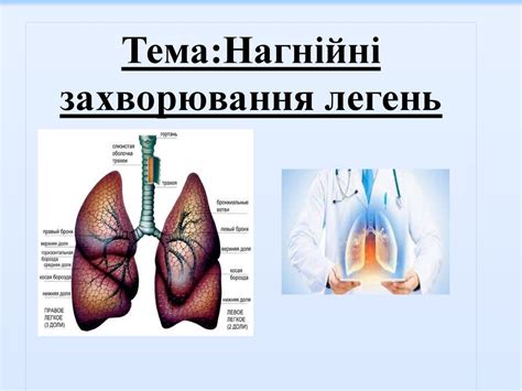 Нагнійні захворювання легень презентация онлайн