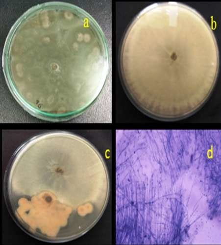 Antagonism Of Trichoderma Viride Against Penicillium Chrysogenum And Download Scientific