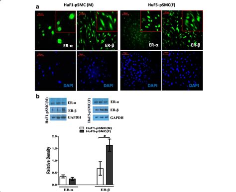 Expression Of Estrogen Receptors In Male And Female Smooth Muscle