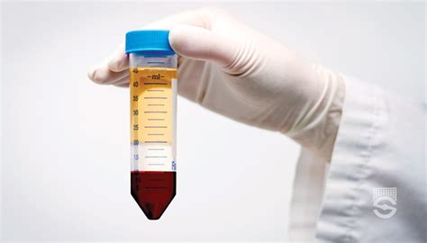 How To Speed Up Your Pbmc Isolations With Sepmate™