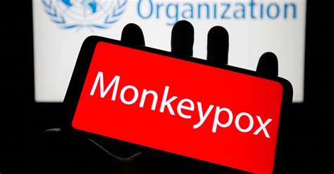 Who Approves First Monkeypox Diagnostic Test Under Emergency Use The