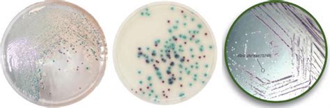 Plate Culture For Isolation And Detection Of A Vibrio Using Download Scientific Diagram