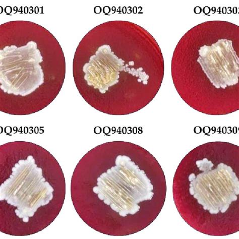 The Hemolytic Properties Of Enterococcus Faecium Isolates Were Compared Download Scientific