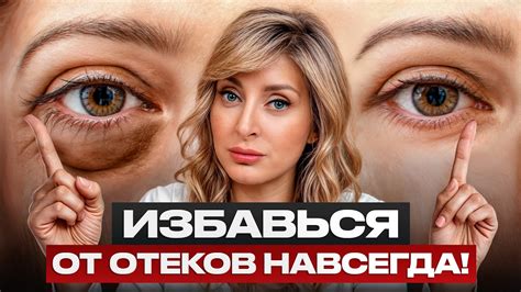 САМЫЕ эффективные средства от мешков под глазами! / Как БЫСТРО ...
