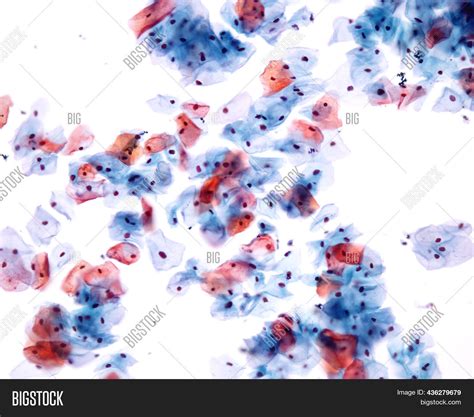 Vaginal Smear Stained Image Photo Free Trial Bigstock