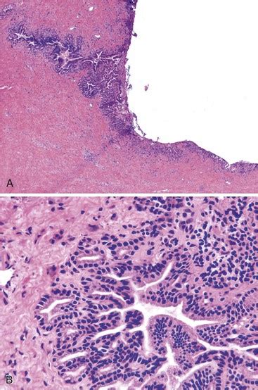 Gallbladder Extrahepatic Biliary Tract And Pancreas Tissue Processing Techniques And Normal