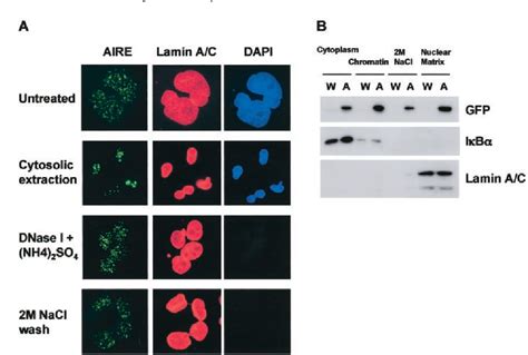 Figure 2 From Subcellular Expression Of Autoimmune Regulator Is Organized In A Spatiotemporal