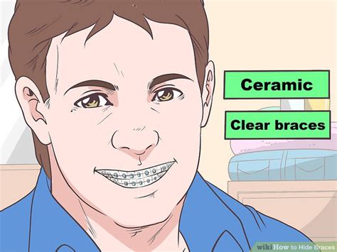Ways To Hide Braces WikiHow