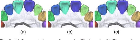 Table 1 From 3d Tooth Segmentation And Labeling Using Deep
