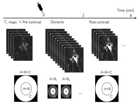 Variable Spatiotemporal Resolution Three Dimensional Dixon Sequence For Rapid Dynamic Contrast