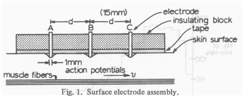 Figure 1 From Direct On Line Estimation Of Muscle Fiber Conduction Velocity By Surface