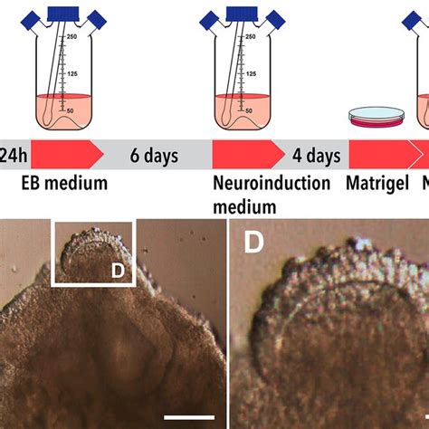 Cerebral Organoids Derived From Human Embryonic Stem Cells A Download Scientific Diagram