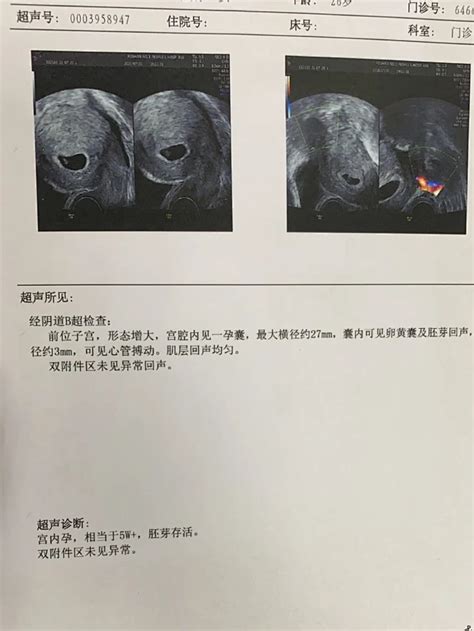 孕七周b超单和hcg 花瓣网