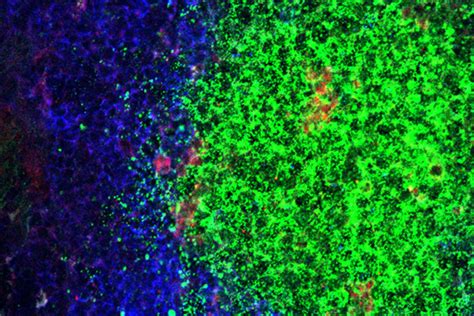 The Division Of Molecular Pathogenesis