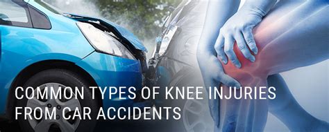 Common Types Of Knee Injuries From Car Accidents