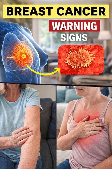 Discover The 10 Important Warning Signs Of Breast Cancer That Every