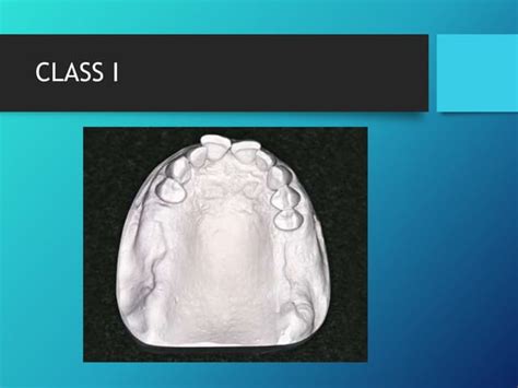 02 Kennedy Classification Pptx Dental Health Diseases And Conditions