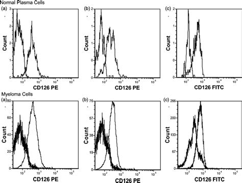 Staining Of Normal Plasma Cells Npcs And Abnormal Plasma Cells Apcs Download Scientific