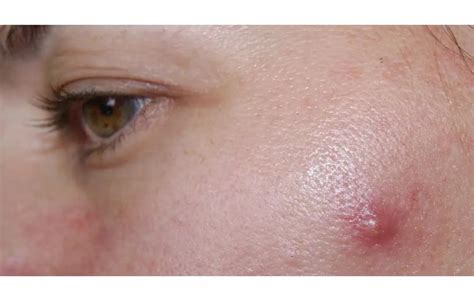 پماد زینک اکساید و هر آنچه درباره آن نمی‌دانید مجله اسنپ مارکت