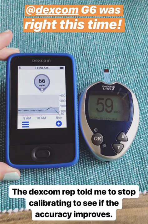 Dexcom G6 Review Artofit