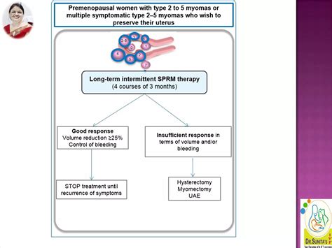 Fibroids And Infertility Ppt