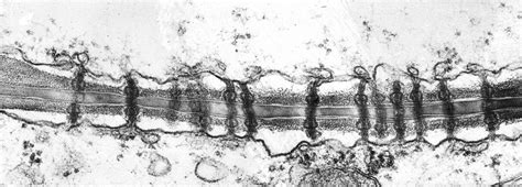 Dictyosomes