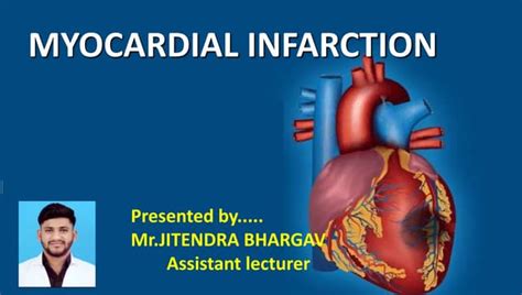 Myocardial Infarction Slideshare Pptx